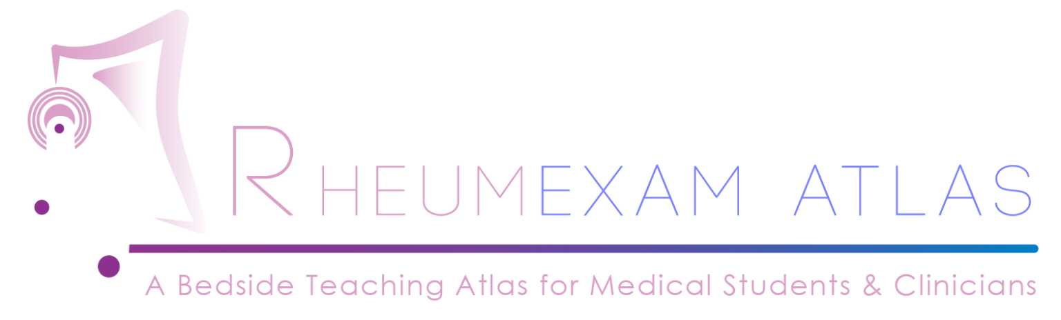 Gottron’s Rash – RheumExam Atlas
